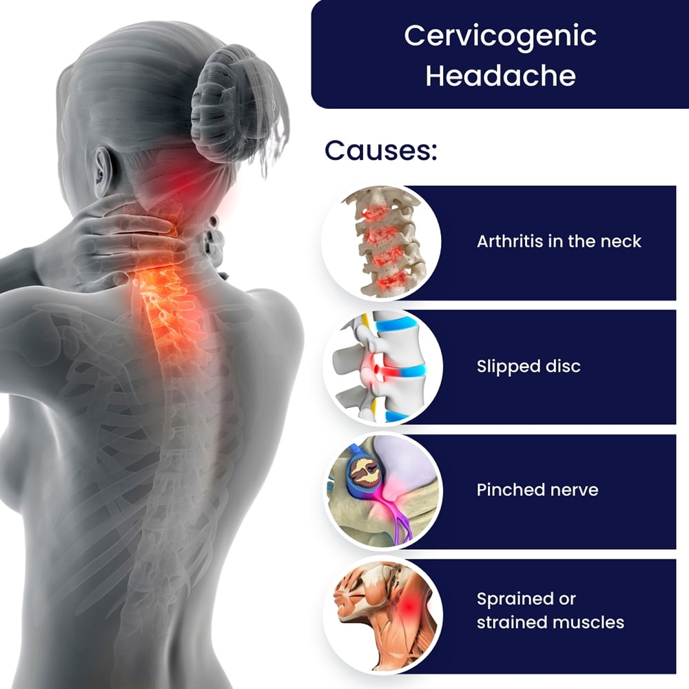 Cervicogenic Headache Treatment in Brooklyn, NYC & NJ Cervicogenic Headache Treatment in Brooklyn, NYC & NJ