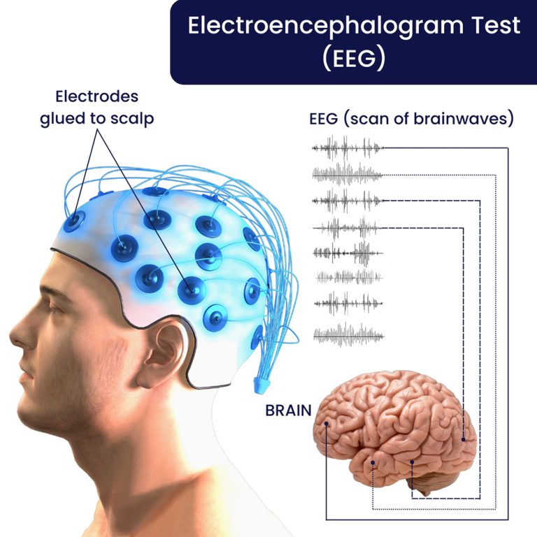 EEG Test in Brooklyn, NYC & NJ | Electroencephalogram Near You