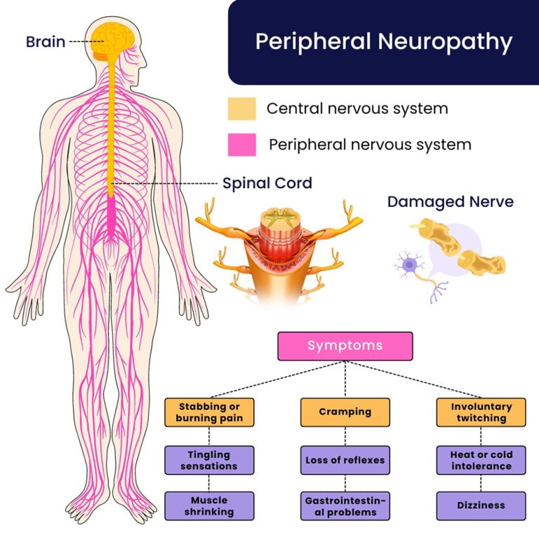 Peripheral Neuropathy Treatment Doctors in Brooklyn, NYC & NJ