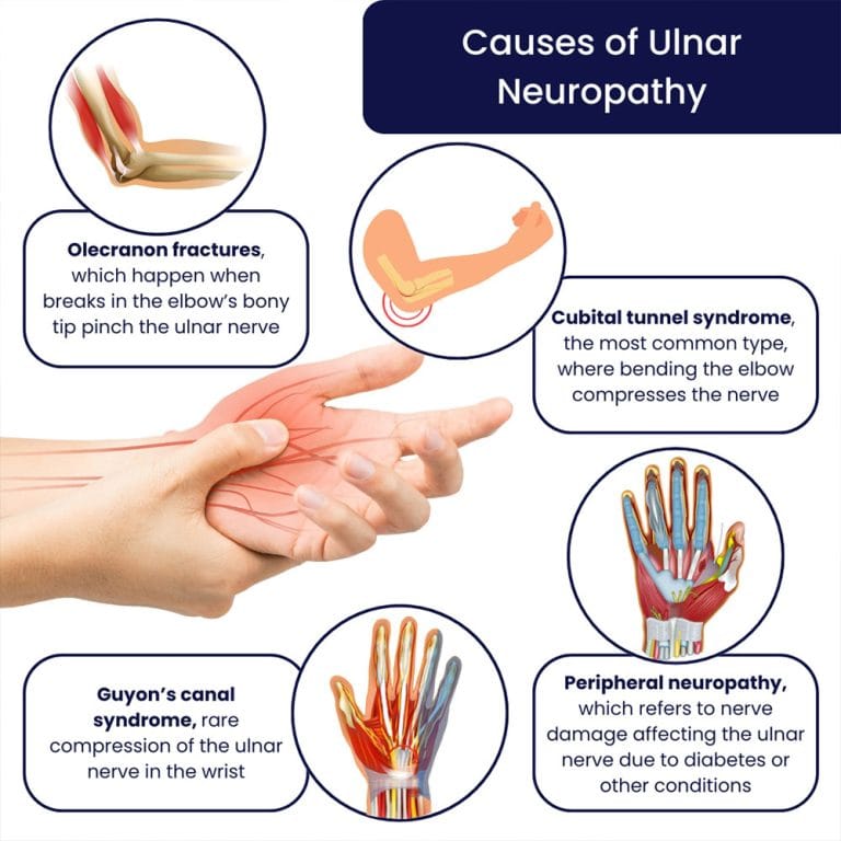 Ulnar Neuropathy Treatment Doctors in Brooklyn, NYC & NJ