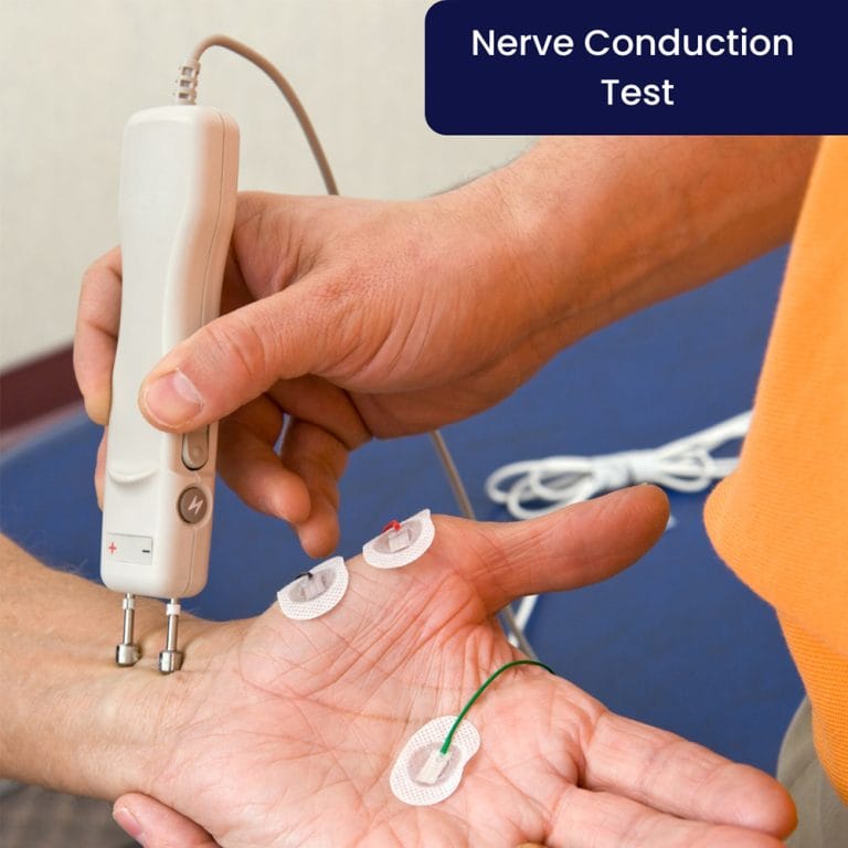 Nerve Conduction Test in Brooklyn, NYC & NJ | NCV Exam