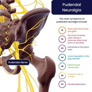 Pudendal Neuralgia Treatment Specialist in Brooklyn, NYC & NJ