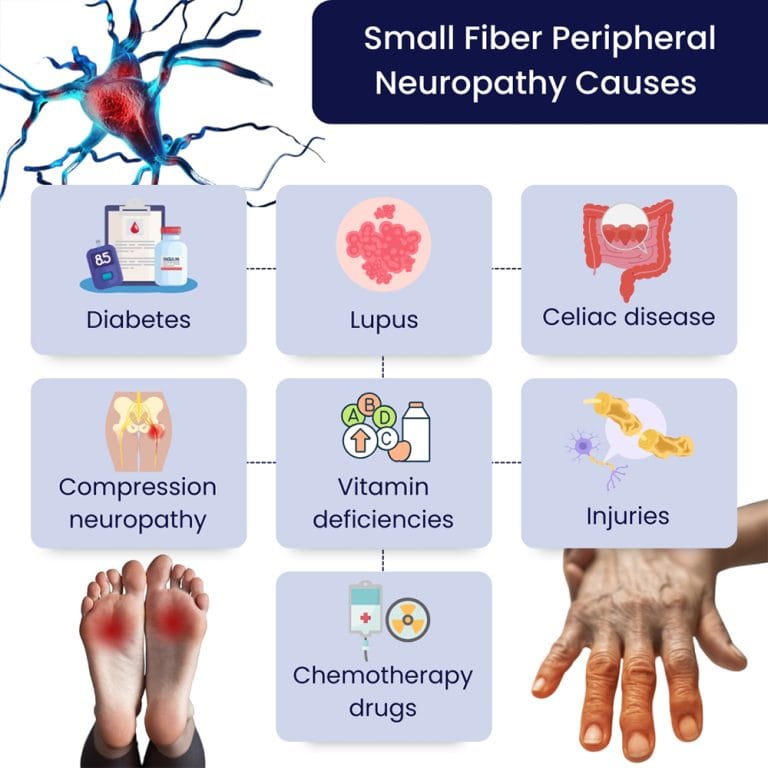 Small Fiber Neuropathy Treatment Doctors in Brooklyn, NYC & NJ